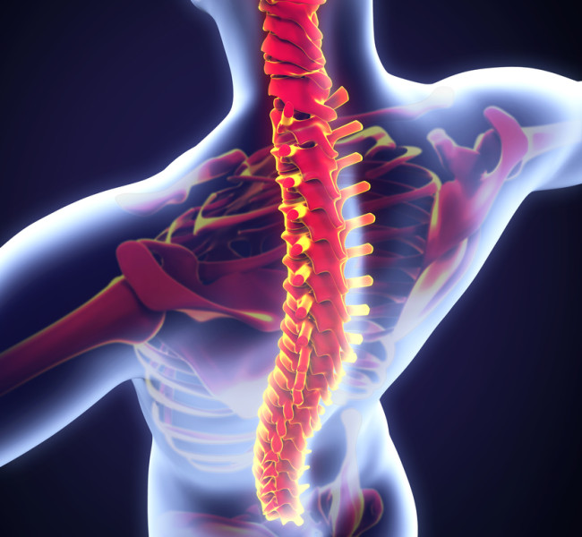 Top in Form | STÄRKE DEINEN RÜCKEN MIT RÜCKENFIT!